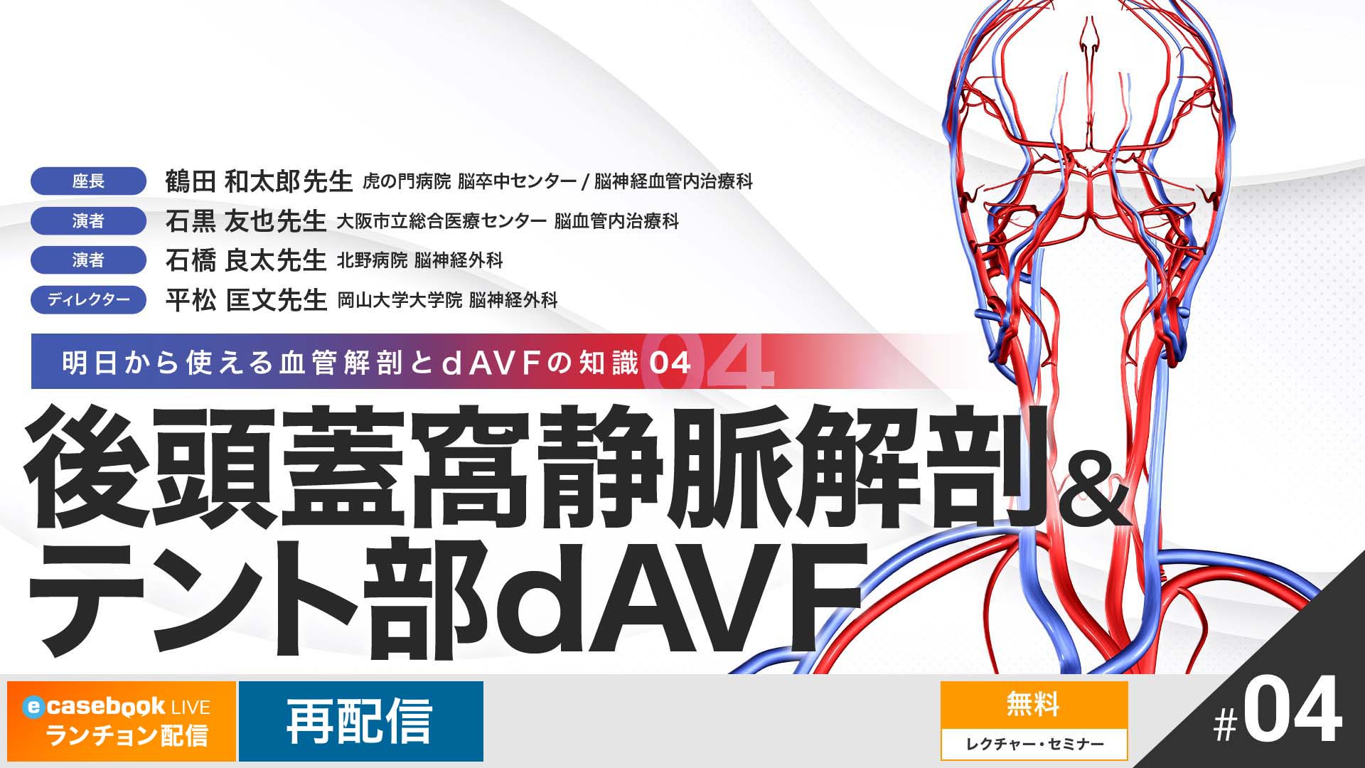 LIVE: 【再】明日から使える血管解剖とdAVFの知識 #04 / 後頭蓋窩静脈解剖&テント部dAVF | Neurology ・ Neurosurgery | e-casebook LIVE