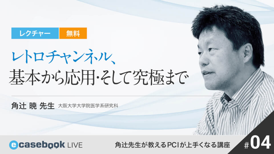 VIDEO: レトロチャンネル、基本から応用・そして究極まで | Cardiology | e-casebook LIVE