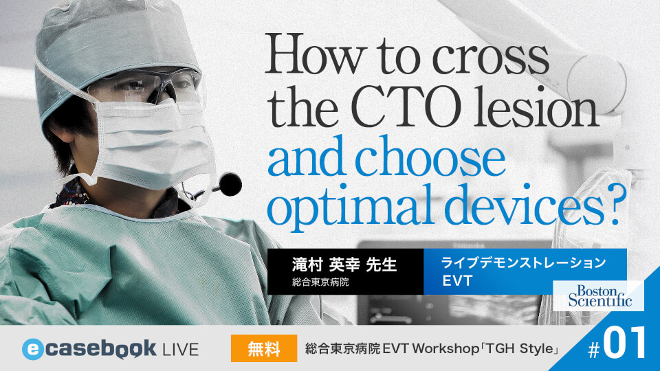 VIDEO: How to cross the CTO lesion and choose optimal devices ...