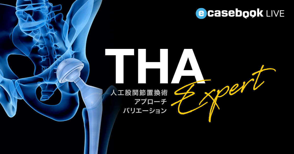 THA Expert | e-casebook