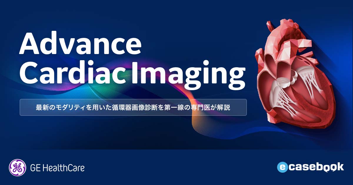 Advanced Cardiac Imaging | Cardiology | e-casebook
