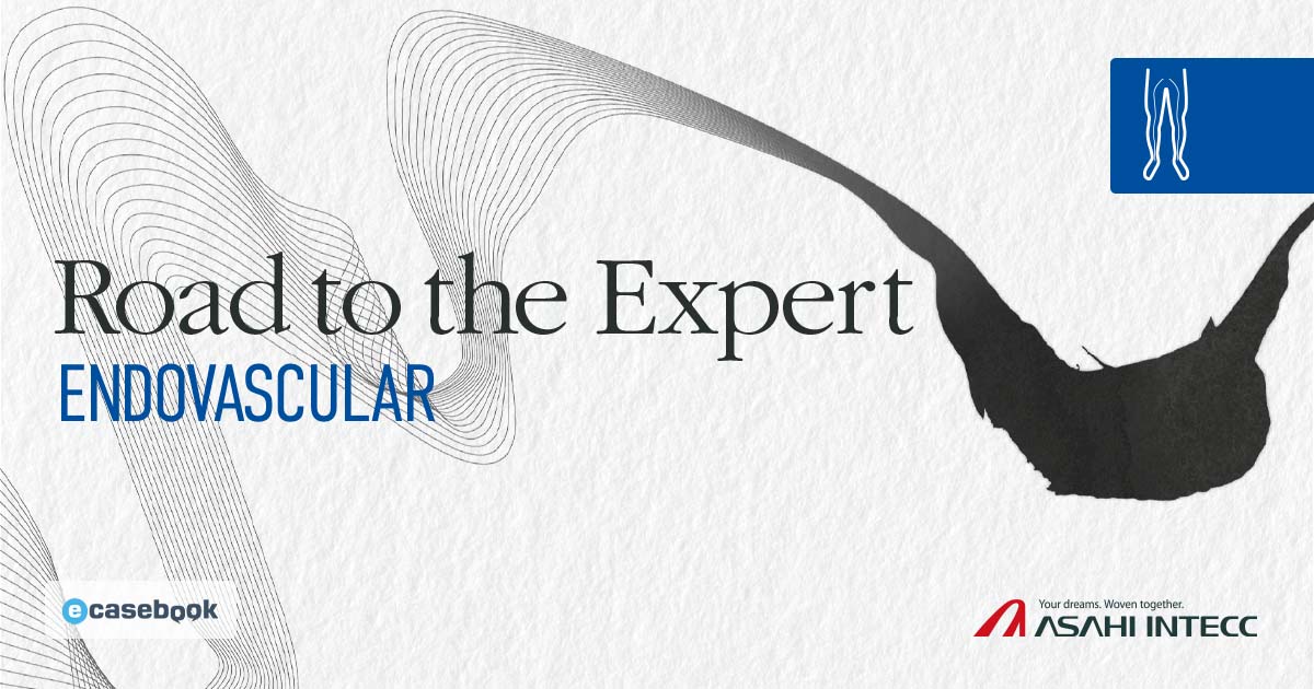 Road to the Expert【Endovascular】 | Cardiology | e-casebook