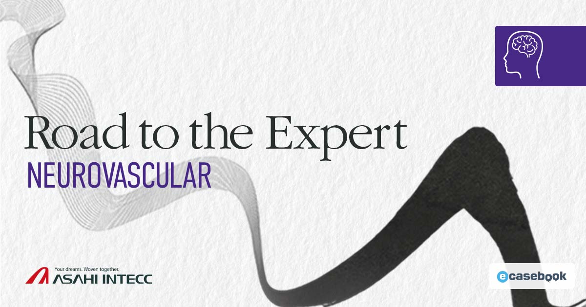 Road to the Expert【Neurovascular】 | e-casebook